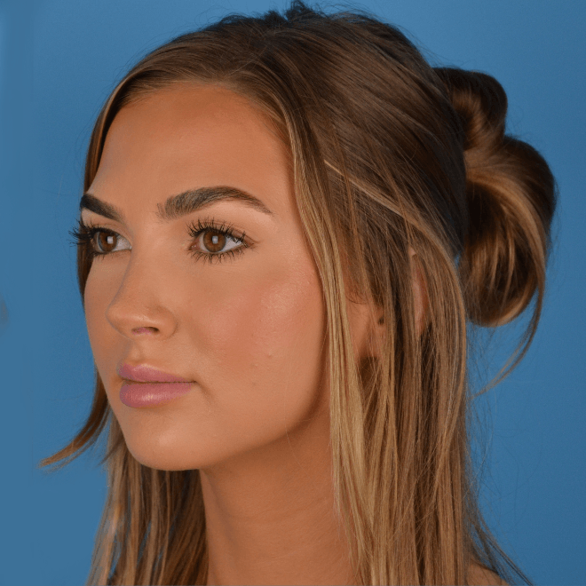 Bader Facial Plastics | Plastic Surgery Plano and Dallas