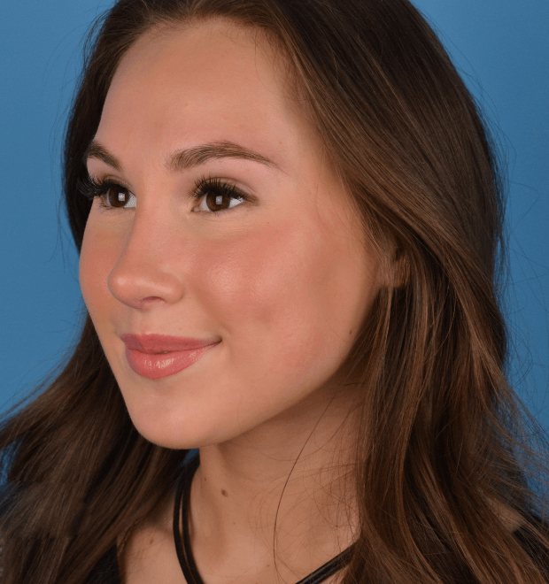 Bader Facial Plastics | Plastic Surgery Plano and Dallas